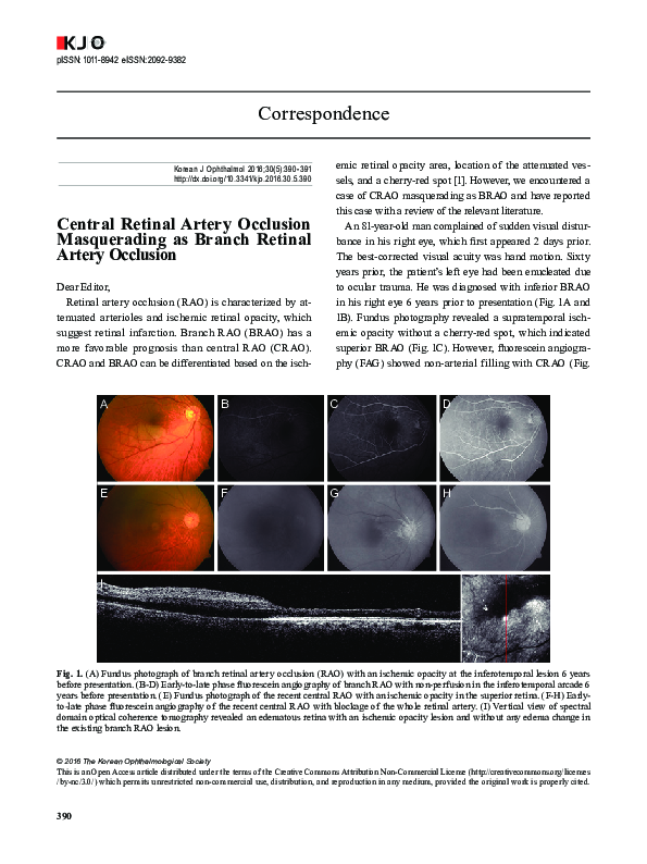 (PDF) Central Retinal Artery Occlusion Masquerading as Branch Retinal ...
