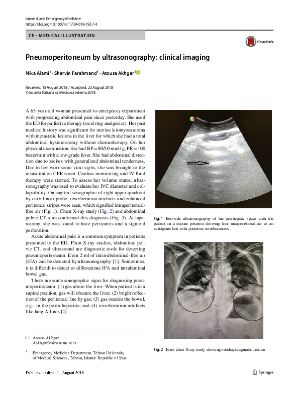 (PDF) Pneumoperitoneum by ultrasonography: clinical imaging
