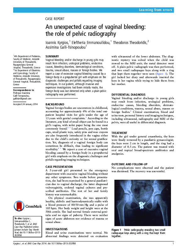 (PDF) An unexpected cause of vaginal bleeding: the role of pelvic ...