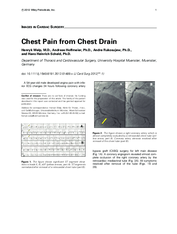 (PDF) Chest Pain from Chest Drain | Dominik Schlarb - Academia.edu