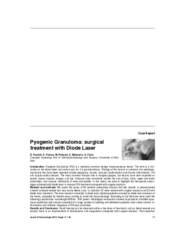 (PDF) Pyogenic Granuloma: surgical treatment with Diode Laser