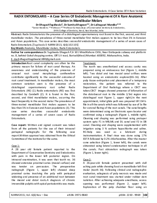 RADIX ENTOMOLARIS-A Case Series Of Endodontic Management Of A Rare ...