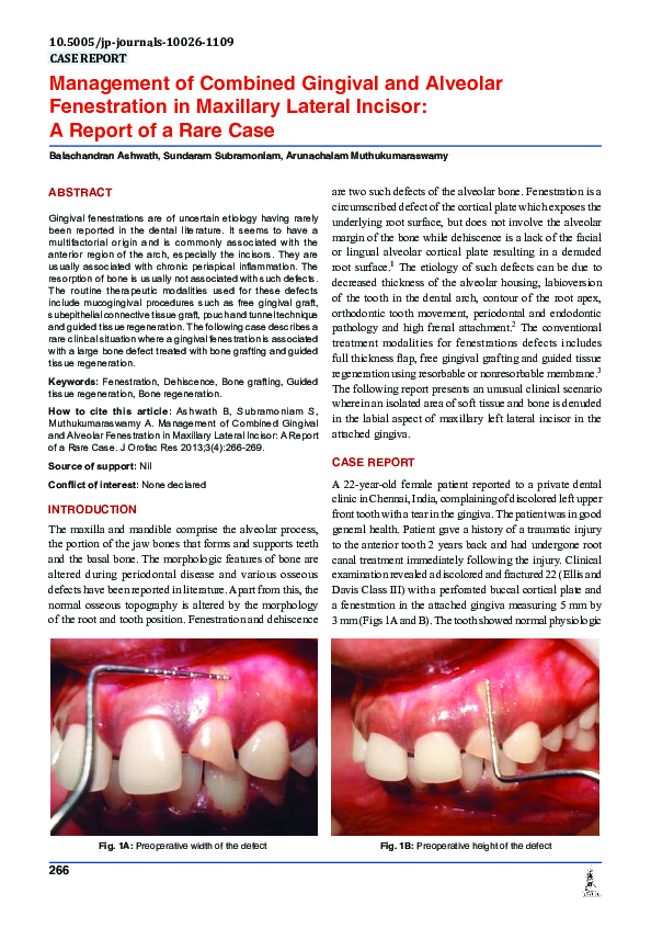 (PDF) Management of Combined Gingival and Alveolar Fenestration in ...