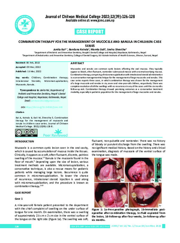 (PDF) Combination Therapy for the Management of Mucocele and Ranula in ...