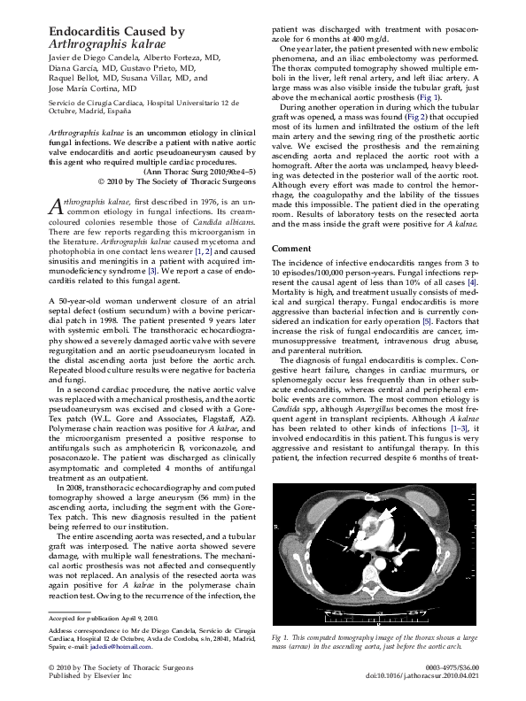 (PDF) Endocarditis Caused by Arthrographis kalrae | Diana García ...