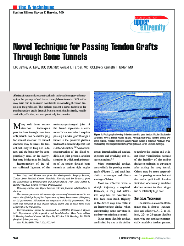 (PDF) Novel Technique for Passing Tendon Grafts Through Bone Tunnels