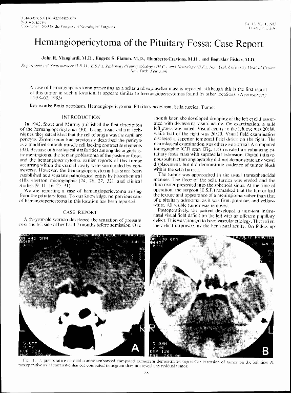 (PDF) Hemangiopericytoma of the pituitary fossa | Eugene Flamm ...