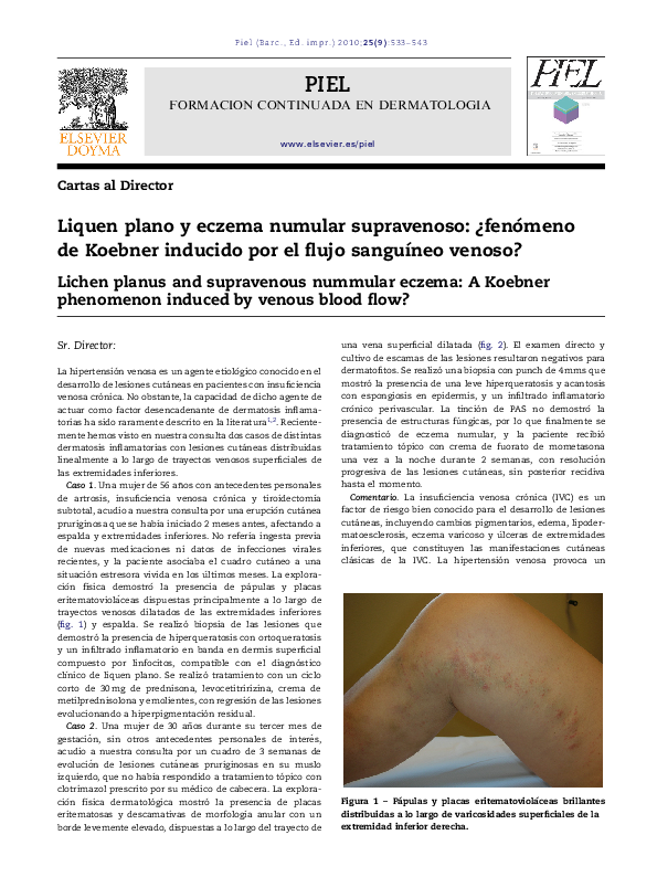(PDF) Liquen plano y eczema numular supravenoso: ¿fenómeno de Koebner ...