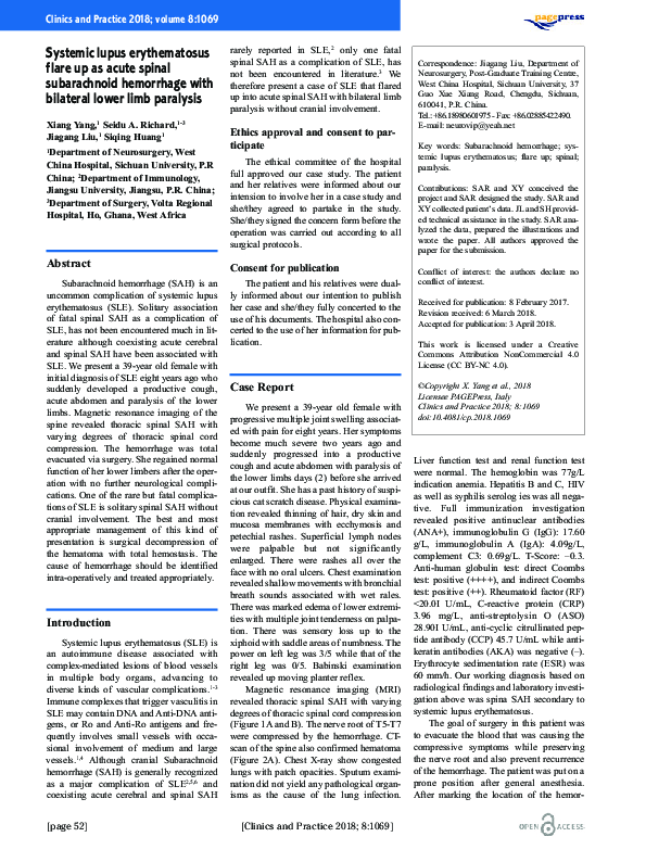 (PDF) Systemic lupus erythematosus flare up as acute spinal ...