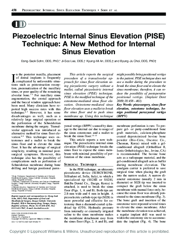 (PDF) Piezoelectric Internal Sinus Elevation (PISE) Technique: A New Method for Internal Sinus ...