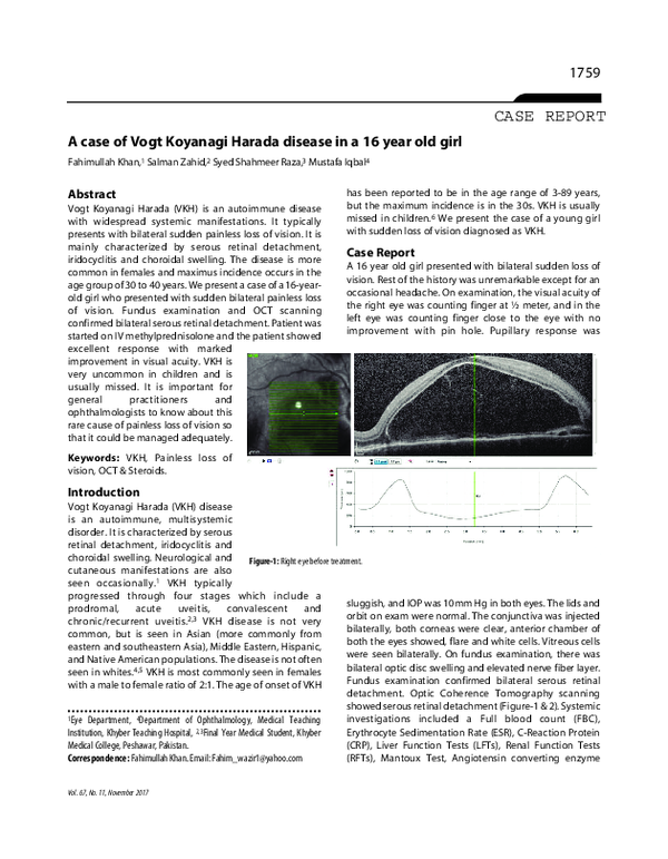 (PDF) A case of Vogt Koyanagi Harada disease in a 16 year old girl