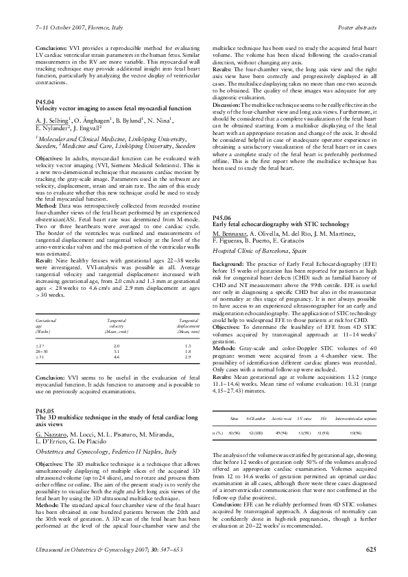 P45.06: Early fetal echocardiography with STIC technology