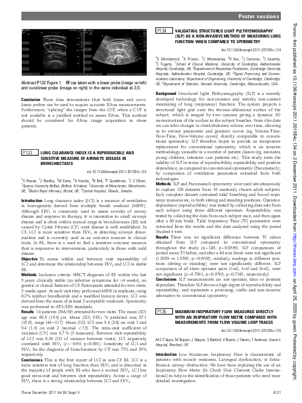 (PDF) P134 Validating structured light plethysmography (SLP) as a non ...