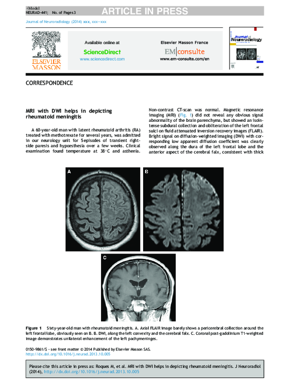 (PDF) MRI with DWI helps in depicting rheumatoid meningitis