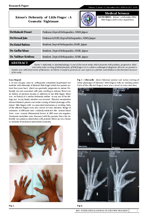 (PDF) Kirner's Deformity of Little Finger : A Cosmetic Nightmare