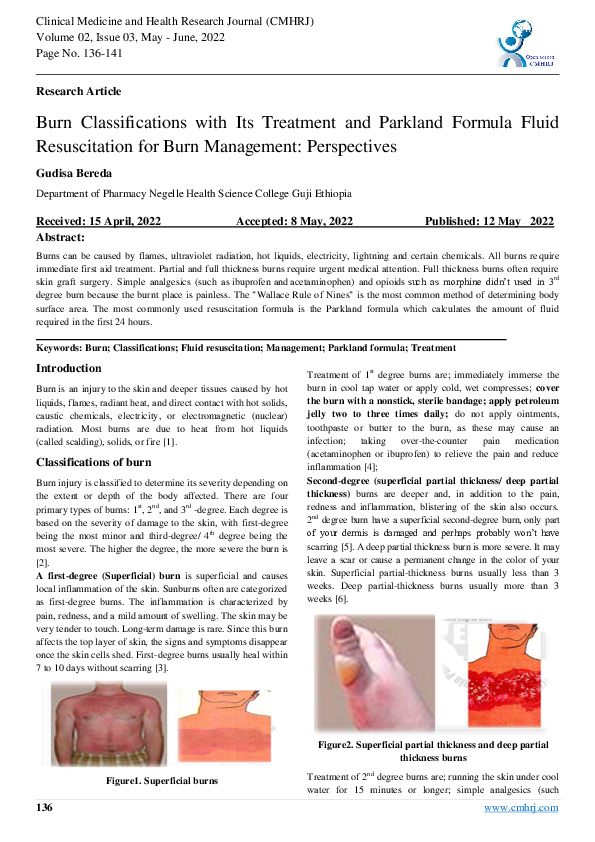 (PDF) Burn Classifications with Its Treatment and Parkland Formula ...