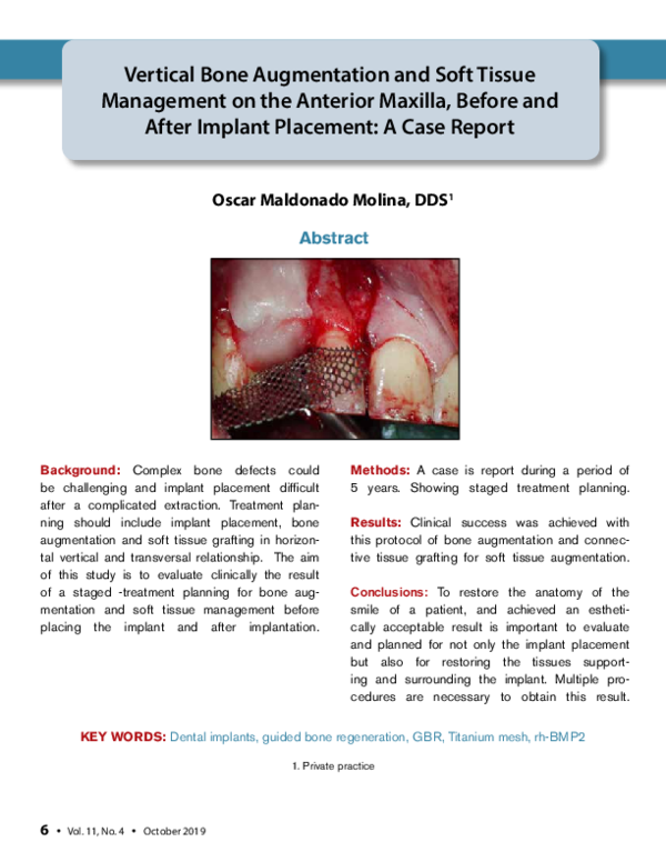 (PDF) Vertical Bone Augmentation and Soft Tissue Management on the Anterior Maxilla, Before and ...