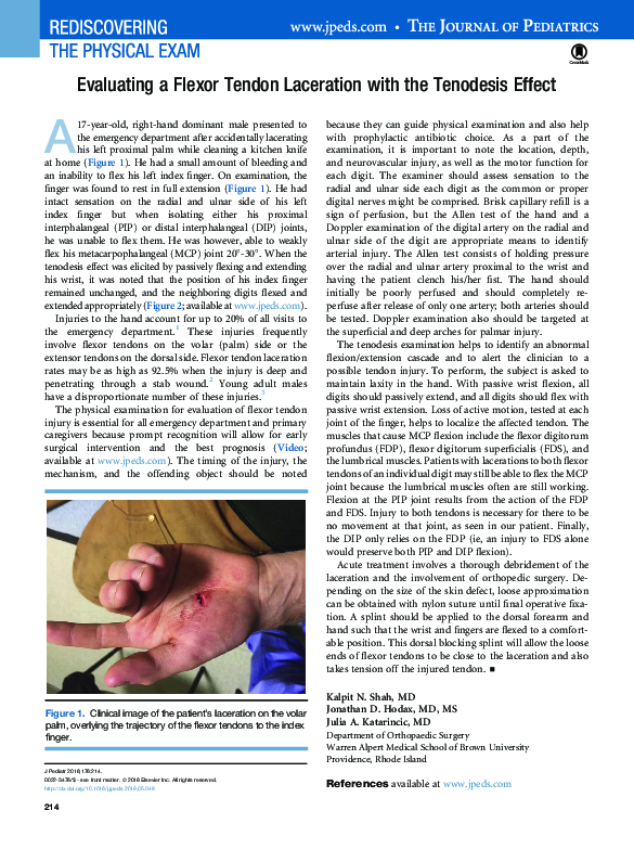 (PDF) Evaluating a Flexor Tendon Laceration with the Tenodesis Effect