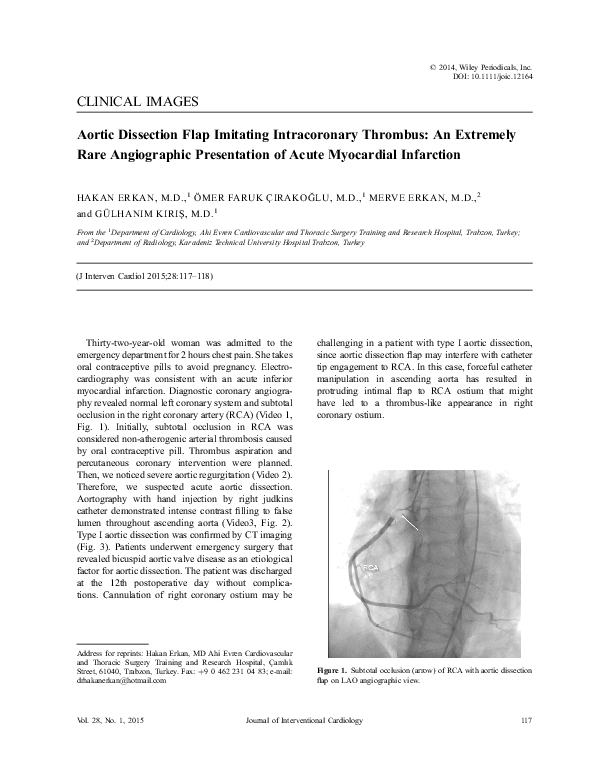 (PDF) Aortic Dissection Flap Imitating Intracoronary Thrombus: An ...