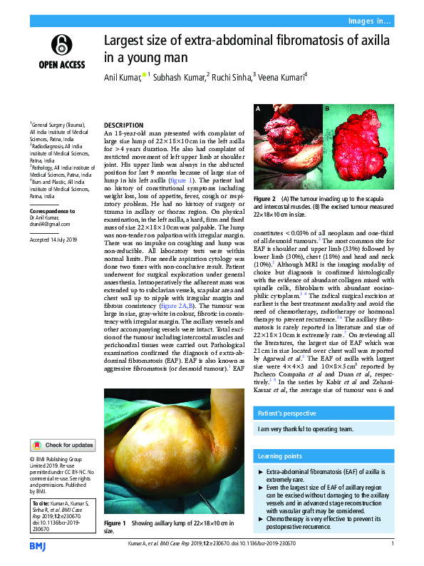 (PDF) Largest size of extra-abdominal fibromatosis of axilla in a young man