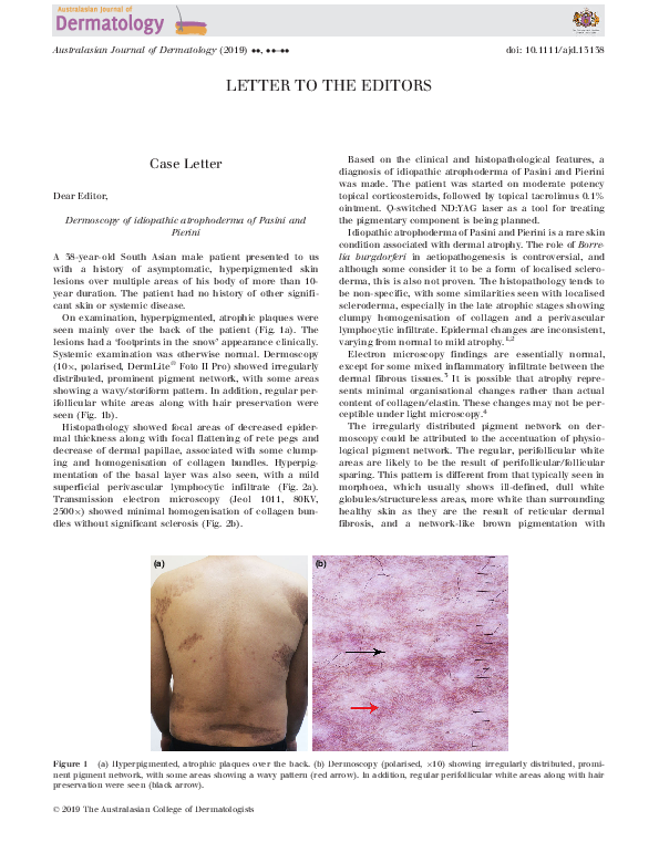 (PDF) Dermoscopy of idiopathic atrophoderma of Pasini and Pierini
