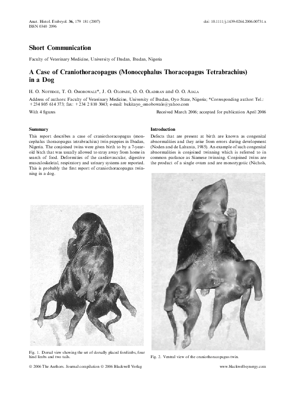 (PDF) A Case of Craniothoracopagus (Monocephalus Thoracopagus ...