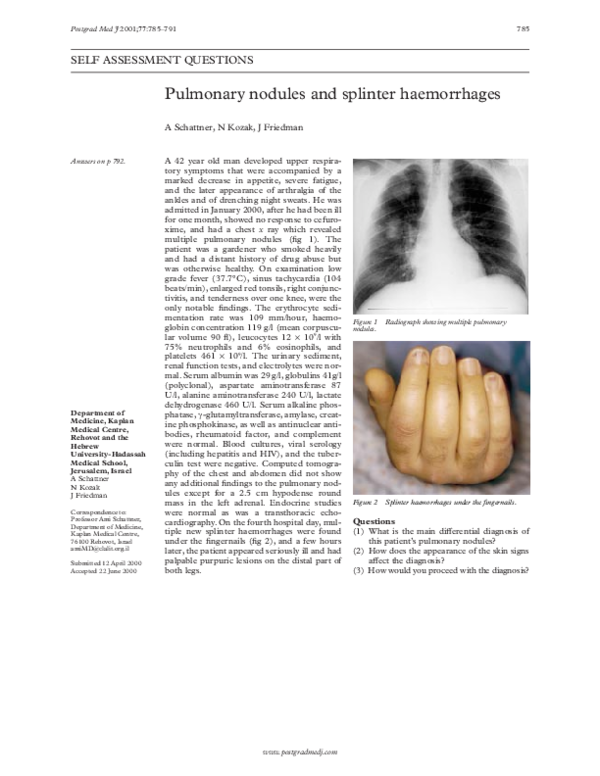 (PDF) Pulmonary nodules and splinter haemorrhages