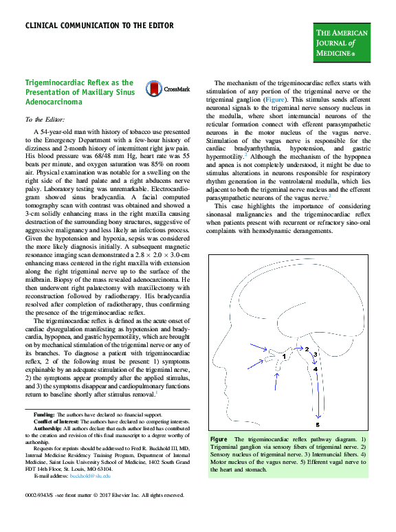 (PDF) Trigeminocardiac Reflex as the Presentation of Maxillary Sinus ...