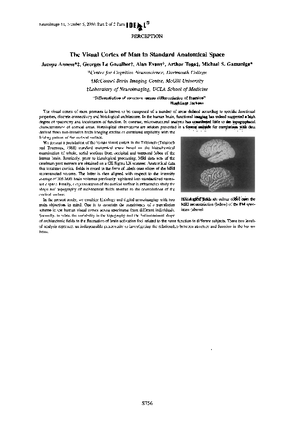 The visual cortex of man in standard anatomical space