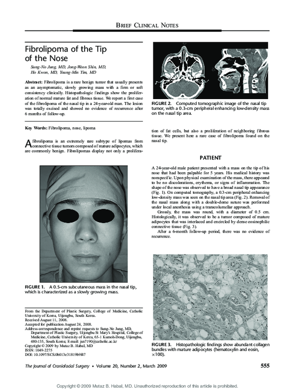 (PDF) Craniofacial Gunshot Injury Resulting in Pseudoaneurysm of the ...