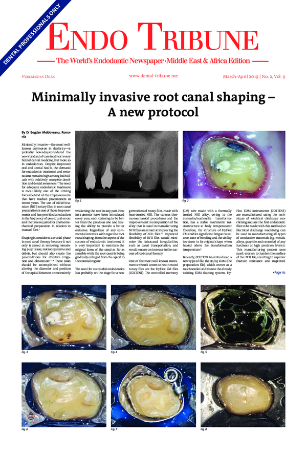 (PDF) Minimally invasive root canal shaping – A new protocol | Bogdan ...