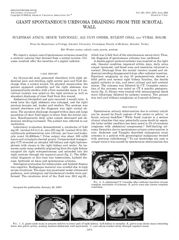 (PDF) Giant Spontaneous Urinoma Draining from the Scrotal Wall