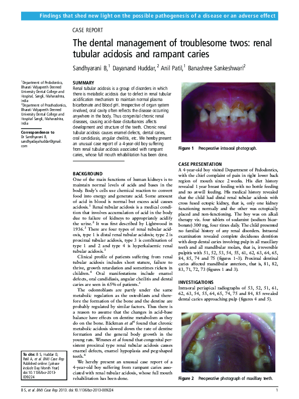 (PDF) The dental management of troublesome twos: renal tubular acidosis ...