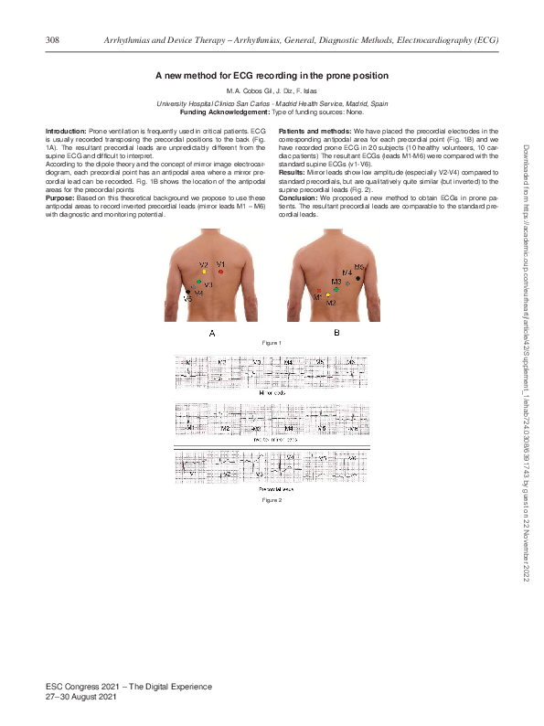 (PDF) A new method for ECG recording in the prone position | Fabián ...