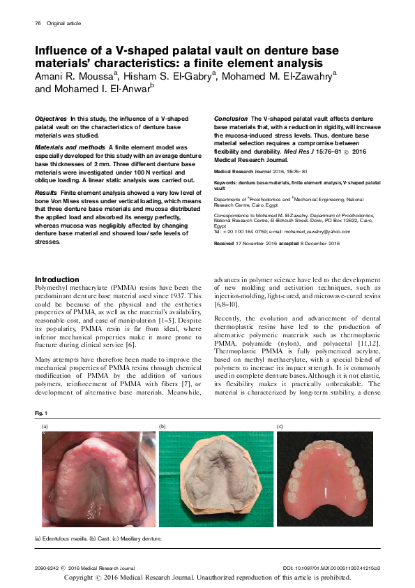 (PDF) Influence of a V-shaped palatal vault on denture base materials ...