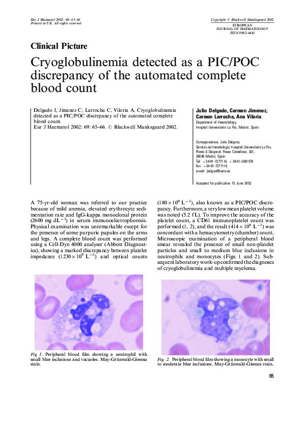 (PDF) Cryoglobulinemia detected as a PIC/POC discrepancy of the ...