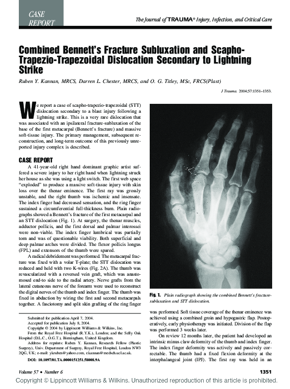 (PDF) Combined Bennett???s Fracture Subluxation and Scapho-Trapezio ...