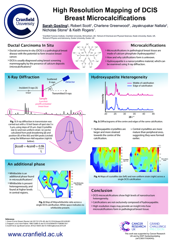 (PDF) High Resolution Mapping of DCIS Breast Microcalcifications ...