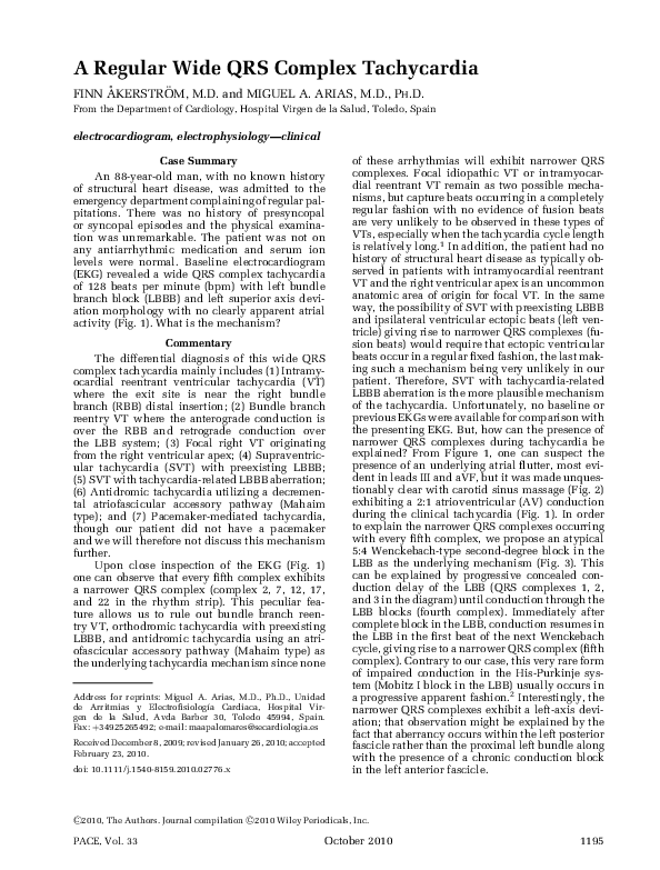 (PDF) A Regular Wide QRS Complex Tachycardia
