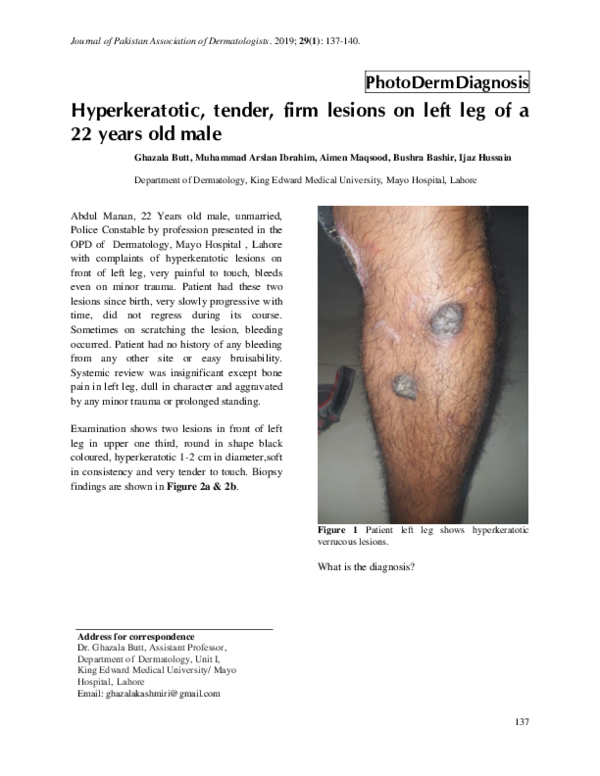 (PDF) Hyperkeratotic, tender, firm lesions on left leg of a 22 years ...