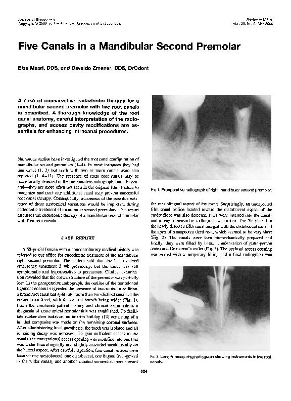 (PDF) Five Canals in a Mandibular Second Premolar