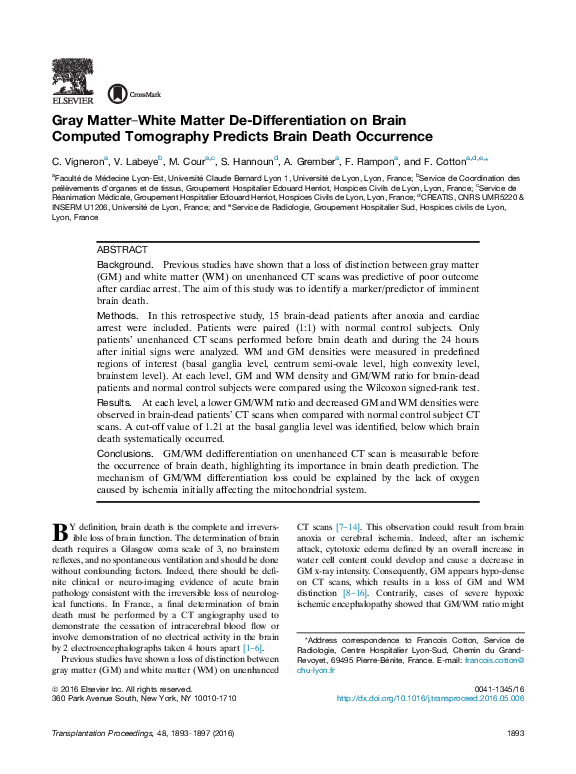 (PDF) Gray Matter–White Matter De-Differentiation on Brain Computed ...