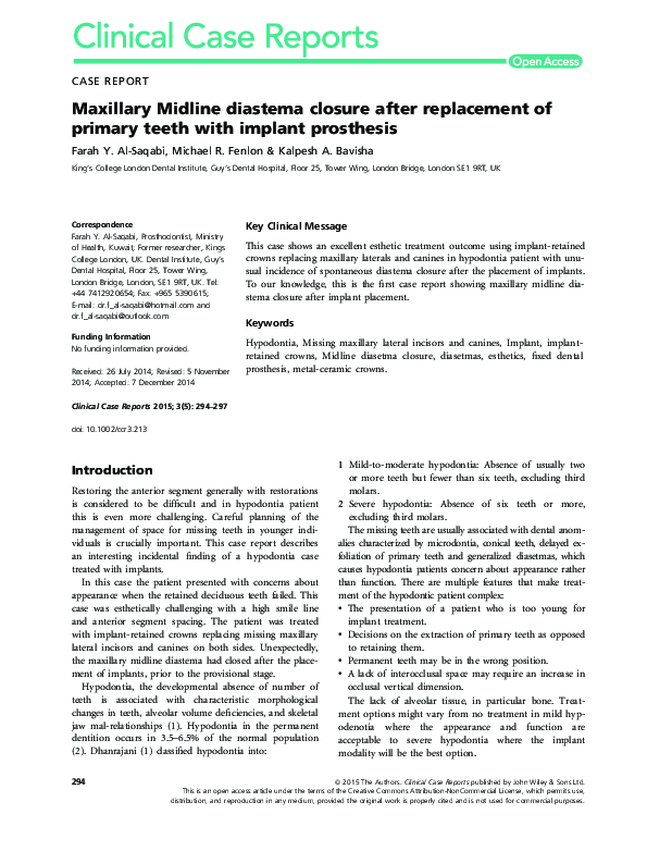 (PDF) Maxillary Midline diastema closure after replacement of primary ...
