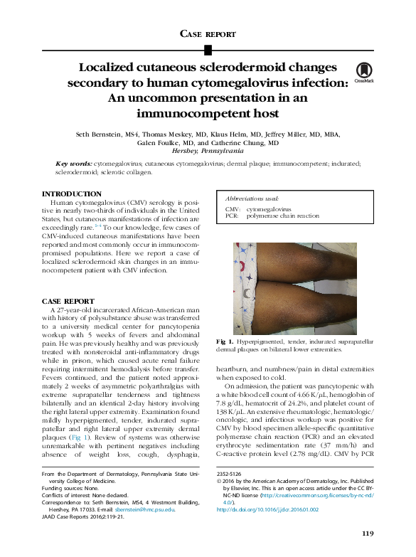 (PDF) Localized cutaneous sclerodermoid changes secondary to human ...