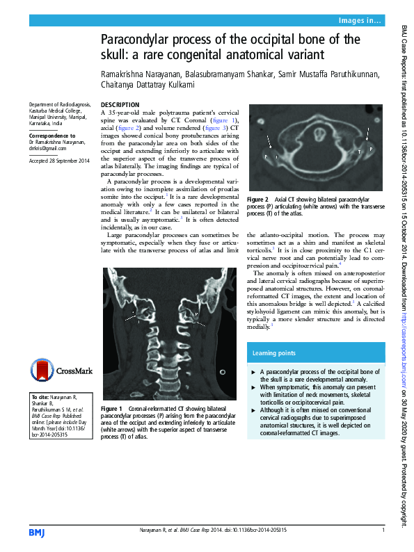 (PDF) Paracondylar process of the occipital bone of the skull: a rare ...