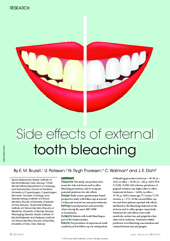 (PDF) Side effects of external tooth bleaching