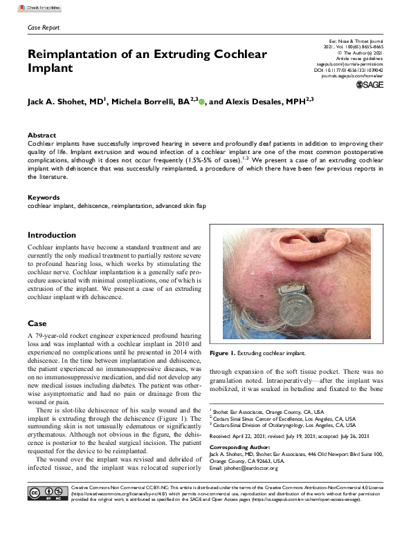 (PDF) Reimplantation of an Extruding Cochlear Implant