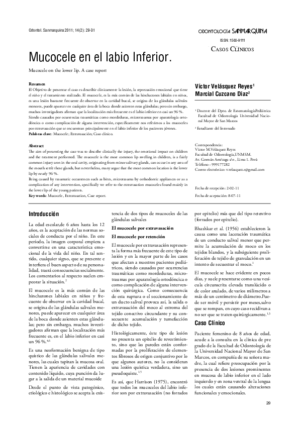 (PDF) Mucocele en el labio Inferior