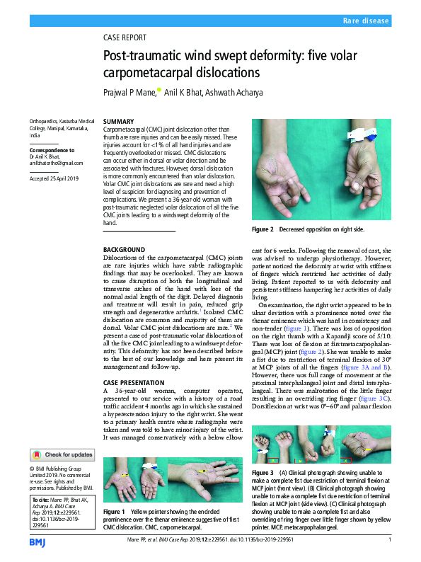 Post-traumatic wind swept deformity: five volar carpometacarpal ...