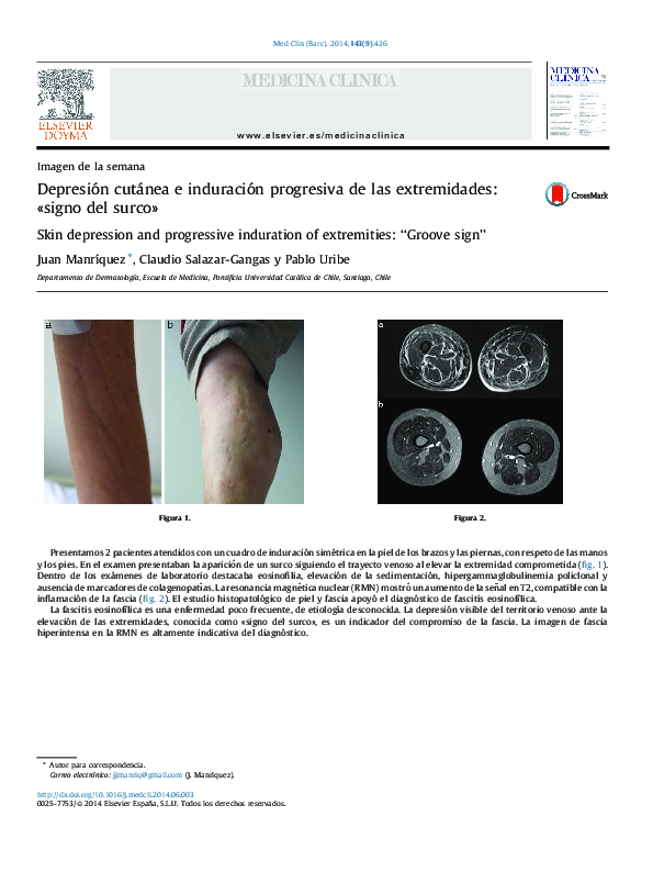 (PDF) Depresión cutánea e induración progresiva de las extremidades ...